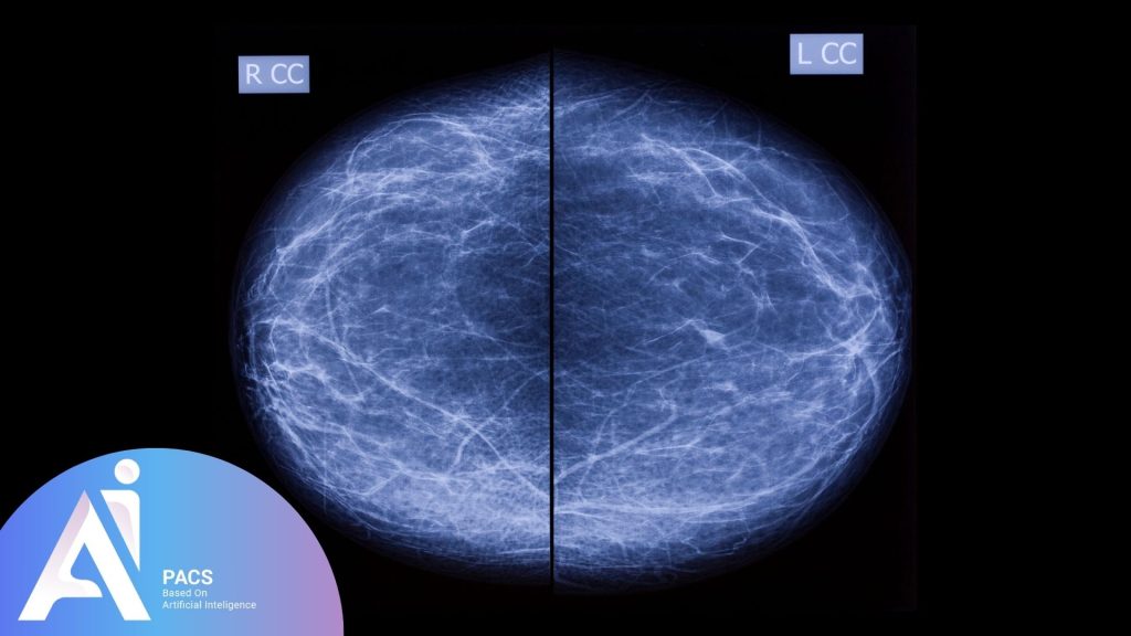 Asymmetry in Mammogram Findings: What You Need to Know