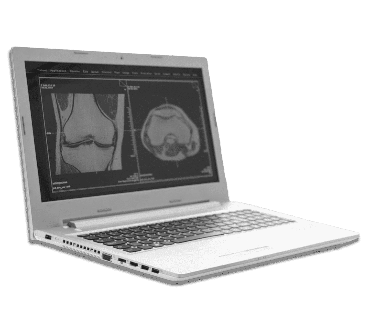 Online Report: Request Expert Radiology Image Analysis