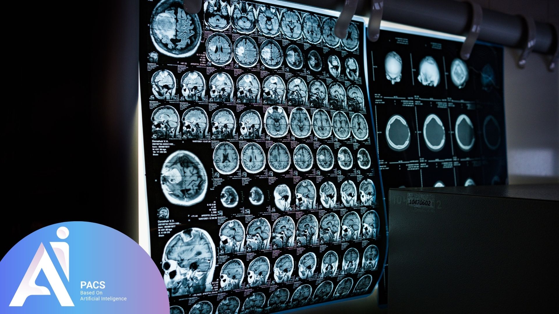Fast MRI Consultation for Second Opinion